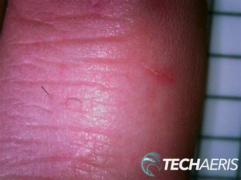 Plugable Usb 2 0 Digital Microscope Review Fairly Easy To Use Microscope With 250x Magnification