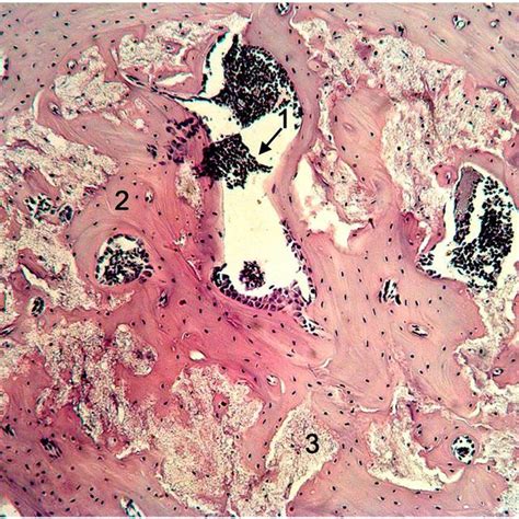 The Area Of The Defect Of Rat Femur On The 60th Day After The Download Scientific Diagram