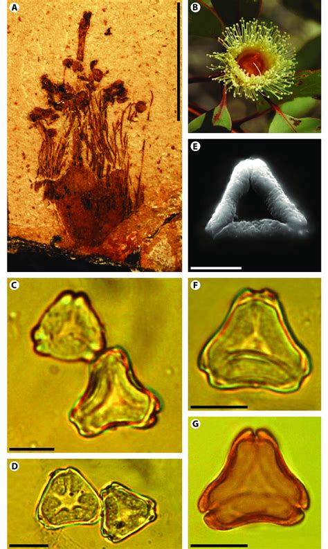 Eucalyptus Xoshemium Gandolfo And Zamaloa Sp Nov Pollen In Situ And Download Scientific