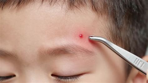Why Plucking Your 4 Year Olds Unibrow Is Unsafe And What To Do Instead