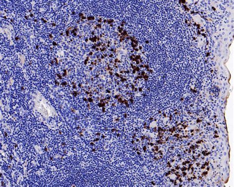 lambda light chain monoclonal antibody a8g3 ma5 44936