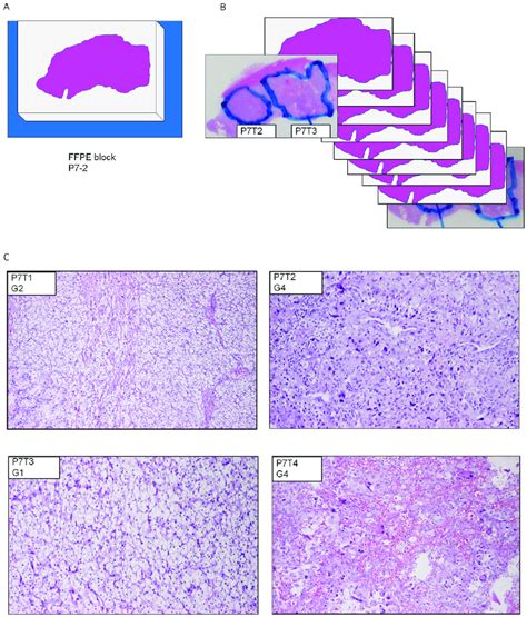 Sample Selection And Dna Isolation Multiple Ffpe Blocks Containing Download Scientific Diagram
