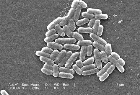 45 Escherichia Coli Gambar Gratis