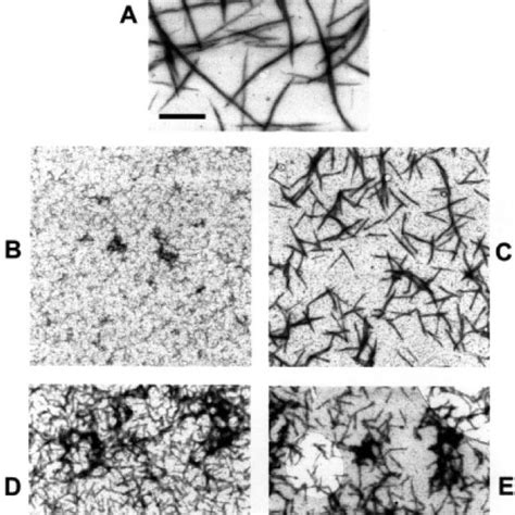 Localization Of Gfp Tagged Smooth Muscle Myosin In Cos 7 Cells During