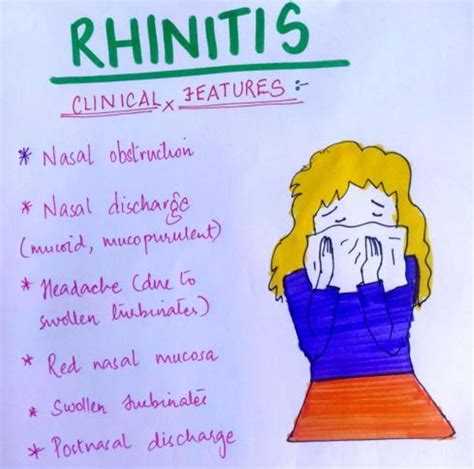 Rhinitis Types Clinical Features Causes And Treatments