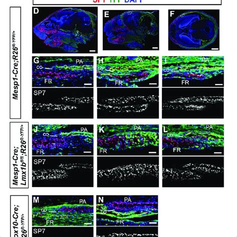 Contribution Of Mesoderm Derived Cells And Neural Crestderived To The Download Scientific