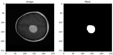 A Unified Pipeline For Simultaneous Brain Tumor Classification And Segmentation Using Fine Tuned