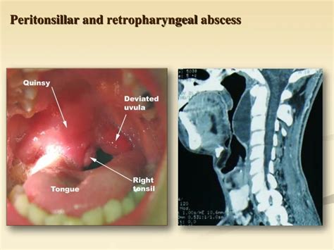 Ppt Pharynx Anatomy And Function Explained Powerpoint Presentation