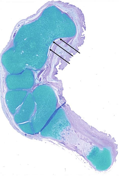 Transverse Histological Section At The Level Of The Calcaneocuboid Download Scientific Diagram