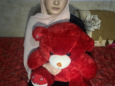 A Year Ago She Drank Battery Acid To Escape Life Under The Taliban