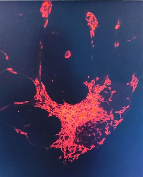 Cellular Communications Through Mitochondrial Trafficking And Networking Confocal Image Of My