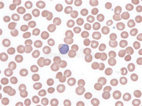 Plasmodium Vivax Schizont In Peripheral Blood Stock Image Image Of