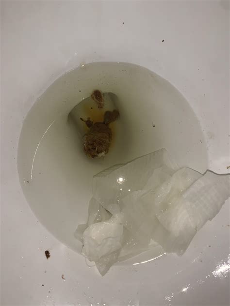 Hello Is This White Stringy Stuff In My Stool Normal Rpoop