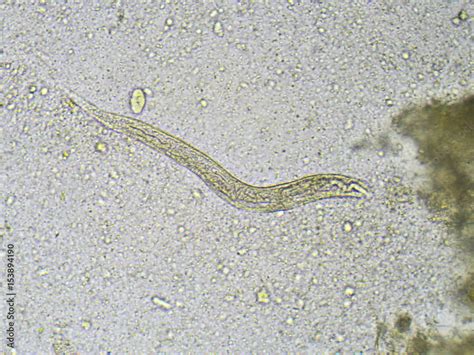 Strongyloides Stercoralis Threadworm In Stool Analyze By Microscope