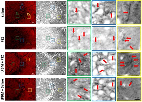 Mitochondrial Cytochrome C Oxidase Subunit 1 Mt Co1 Immunoreactivity Download Scientific