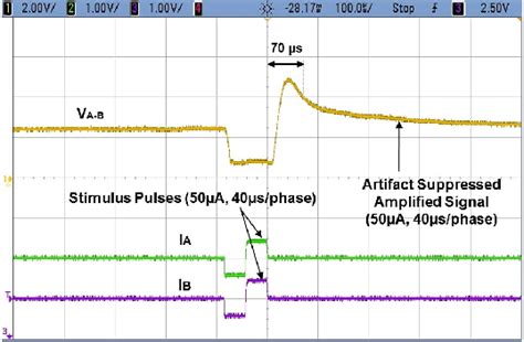 Figure 7 From Sensing Of Stimulus Artifact Suppressed Signals From Electrode Interfaces