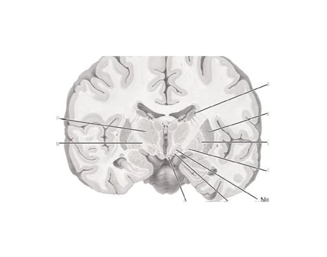 SeccÃo Coronal TelencÉfalo Quiz