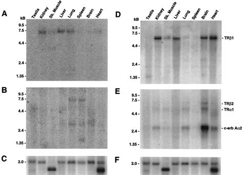 A Multiple Tissue Northern Blot Hybridized To A ␤ 3 Specific Exon B
