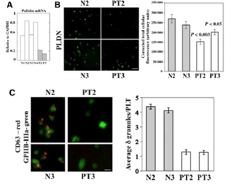 Pallidin Pldn Expression And Cd63 Positive Dense Granules In Download Scientific Diagram