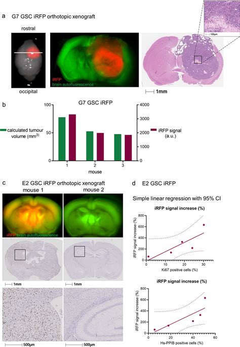 Irfp Signal Correlates With Histological Tumour Burden A