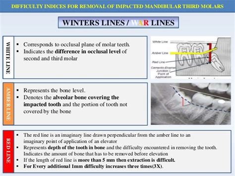 Impaction