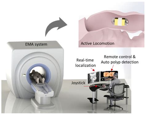Automated Bowel Polyp Detection Based On Actively Controlled Capsule Endoscopy Feasibility