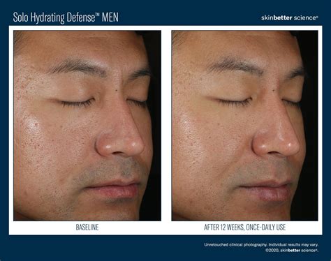 Solo Hydrating Defense Men Admire Plastic Surgery
