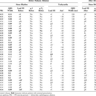 A ECG Showing Minimal Preexcitation RsR Pattern In Lead III Only Download Scientific
