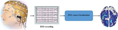 Source Localization Process Of Emotional Eeg Signal Download
