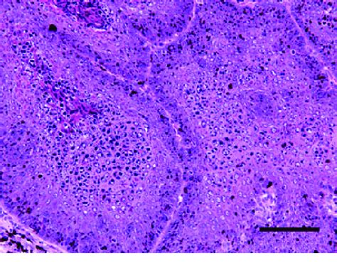 Photomicrograph Of Epidermis Surrounding An In Situ Squamous Cell Download Scientific Diagram