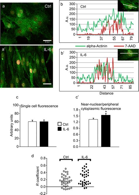 Cellular Localization Of Alpha Actinin In Rat Primary Muscle Cells