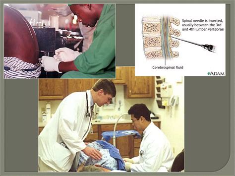 Csf Analysis Presentation Ppt Blood Disorders Diseases And Conditions