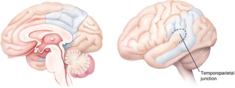 Exam 2 Ch 29 Temporoparietal Association Cortex And Inferior Frontal