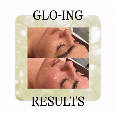 Glo2facial Penobscot Medical Aesthetics