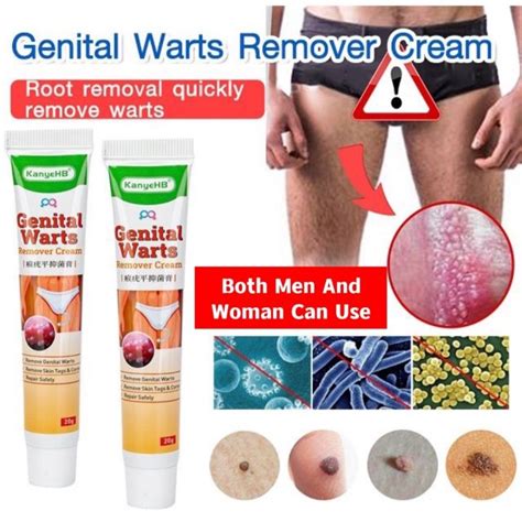Hot Sale Genital Warts Remover Ointment Herpes Genital Condyloma Health