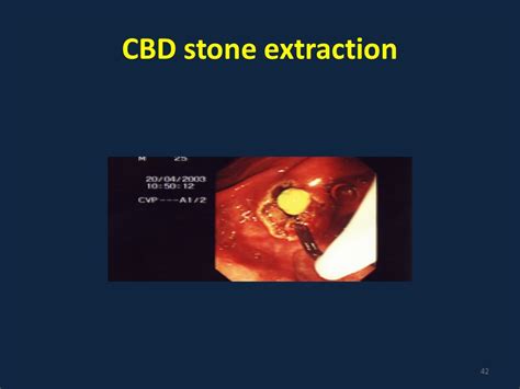 Obstructive Jaundice M K Alam Ms Frcs Ed Ppt Video Online Download