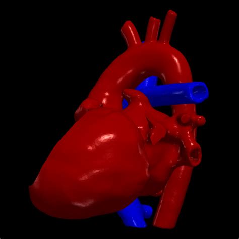 Stl File 3d Model Of Heart After Fontan Procedure 💜・3d Print Design To Download・cults