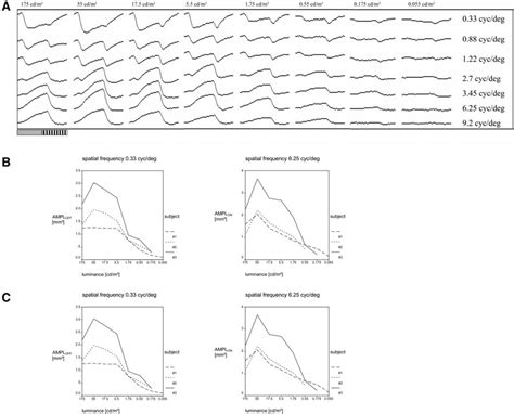 Dependence Of Pupil Response Of Stimulus Luminance And Spatial Download Scientific Diagram