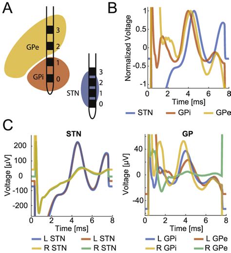 Simultaneous Recordings In The Stn And Gp During Stn Dbs A Dbs