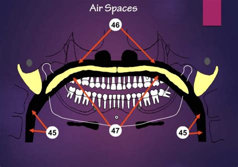 Csce Review Radiology Graph 2 Diagram Quizlet