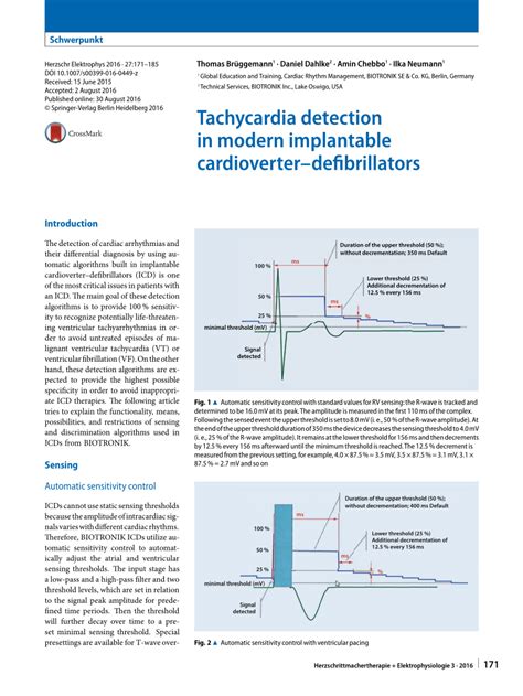 Pdf Tachycardia Detection In Modern Implantable Cardioverter Defibrillators