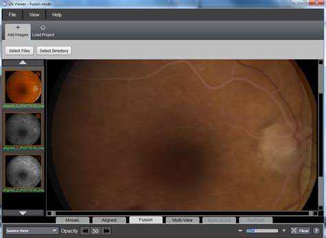 I2k Retina Tutorials Viewer