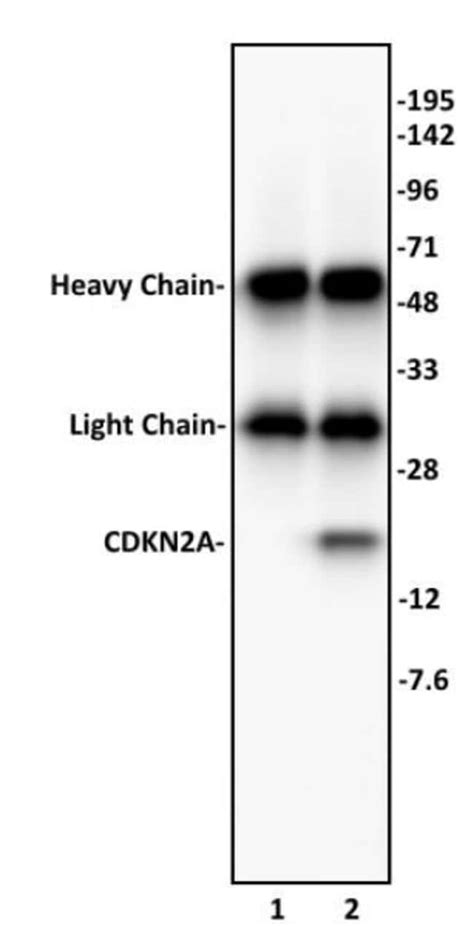 Active Motif Cdkn2a Polyclonal Antibody 10 μl Unconjugated Antibodies