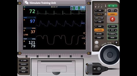 Curare Cleft Capnography Waveform Youtube
