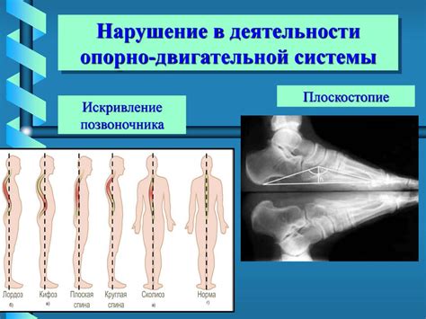 Подготовка к проверочной работе по теме «Опорно двигательная система презентация онлайн