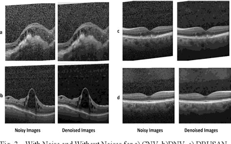 Figure 3 From Retinal Vessel Classification And Segmentation Using Advanced Machine Learning
