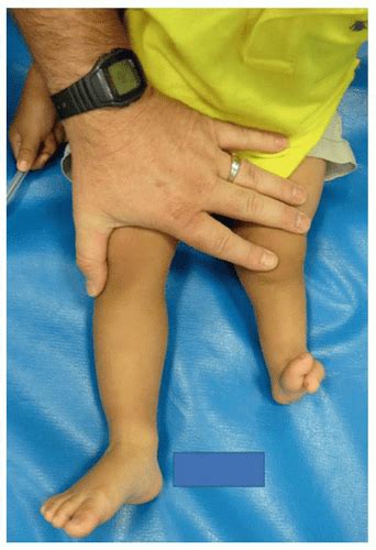 Leg Disorders Musculoskeletal Key