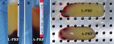 Allmedics L PRF Scientific Literature