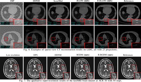 Figure 1 From Bi Level Guided Diffusion Models For Zero Shot Medical Imaging Inverse Problems