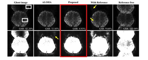 K Space Deep Learning For Reference Free Epi Ghost Correction Deepai